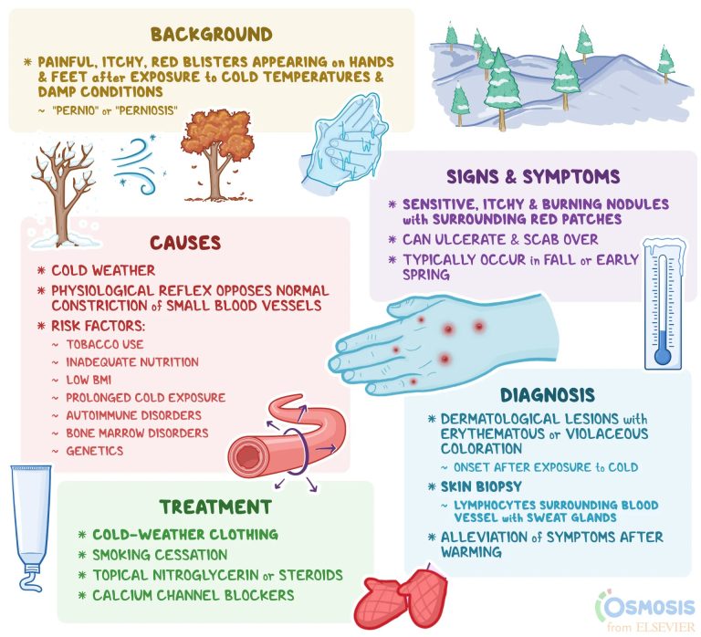 Chilblains: Keeping Your Toes Warm and Understanding the Itch | Causes ...
